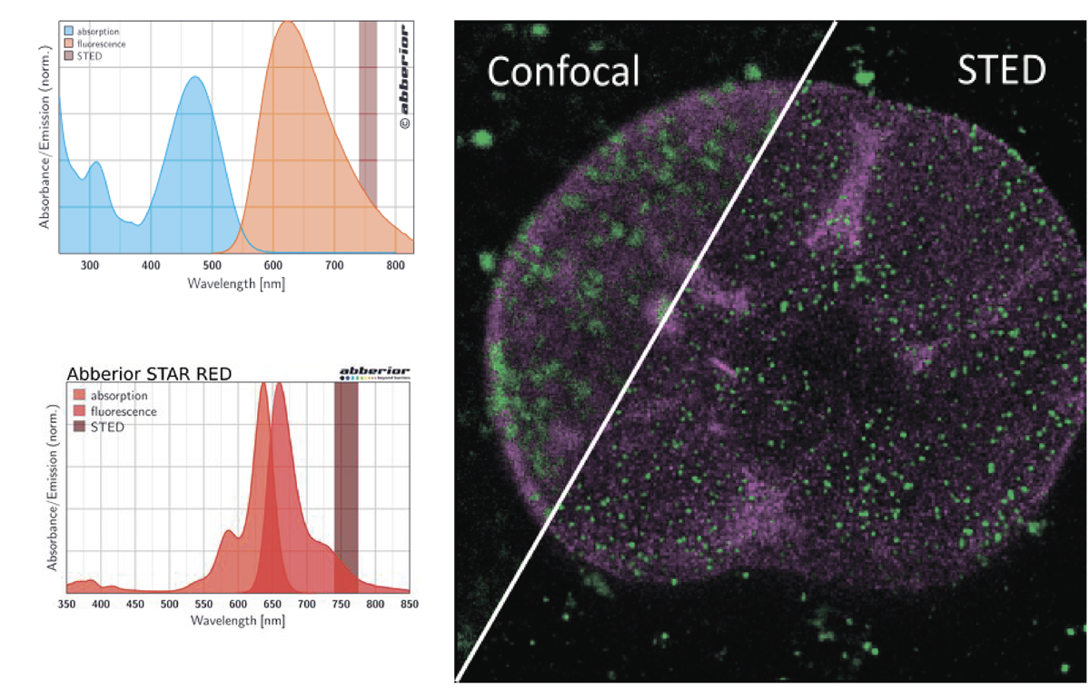 SR STAR 上海宇北医疗器械有限公司